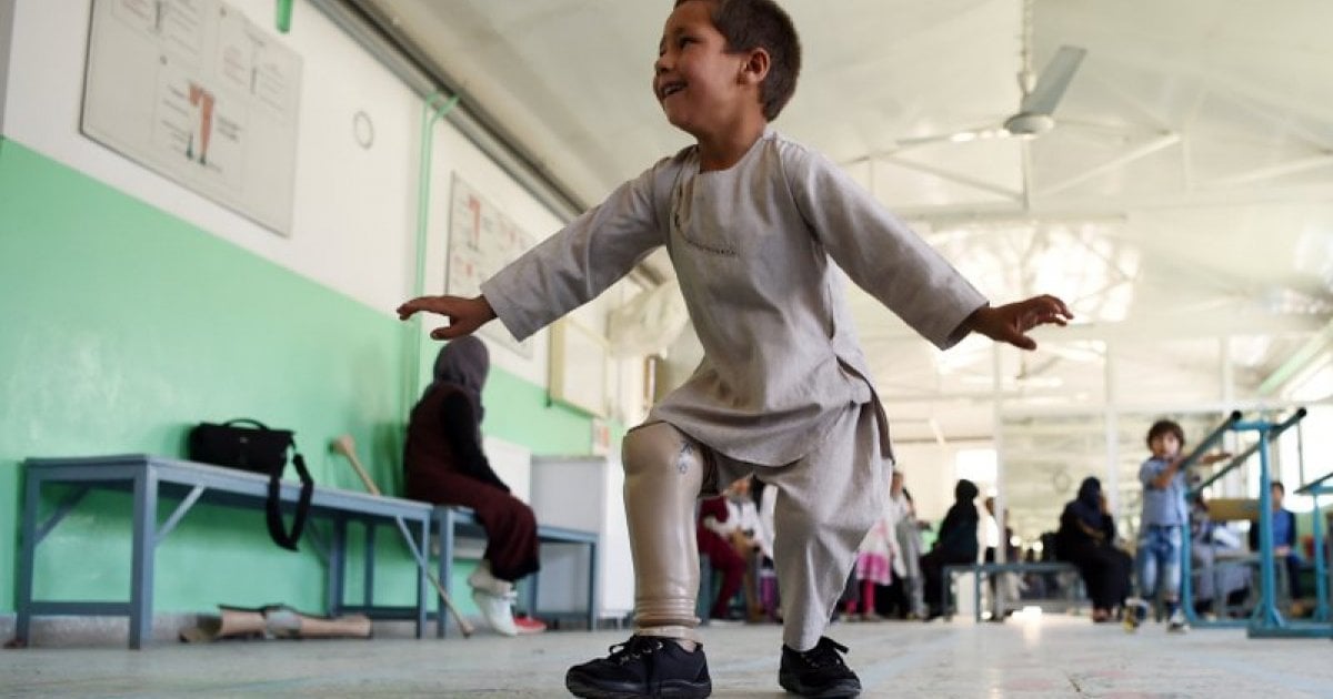 This Little Boy's Dance On Getting Artificial Leg Will Inspire You To ...