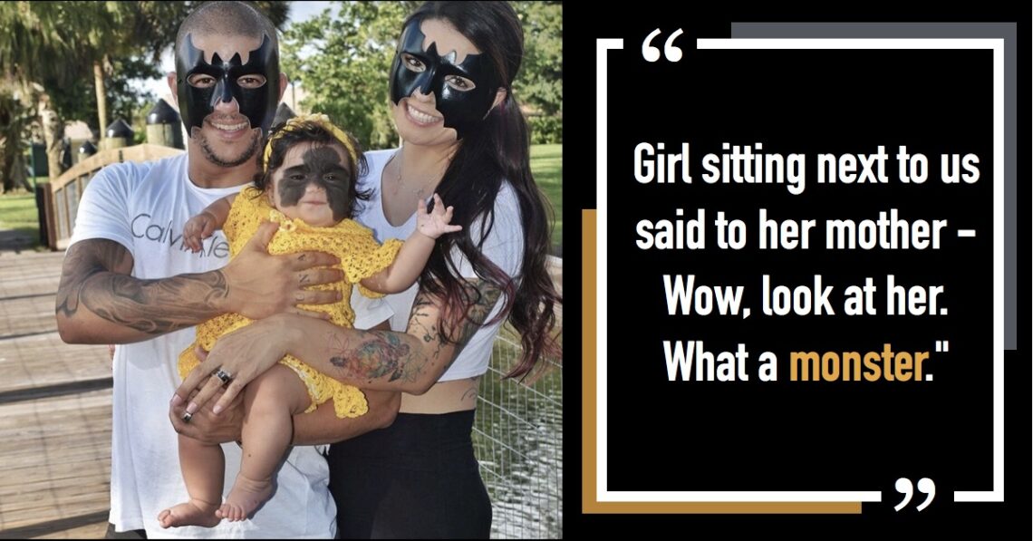 Parents Turned Baby's Birthmark Into 'Batman Mask', Internet Applauds ...