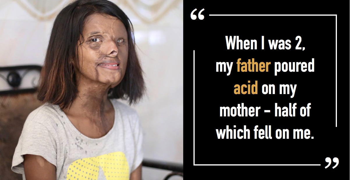 Father Burnt Her Face & Took Her Mom's Life, But This Brave Girl ...